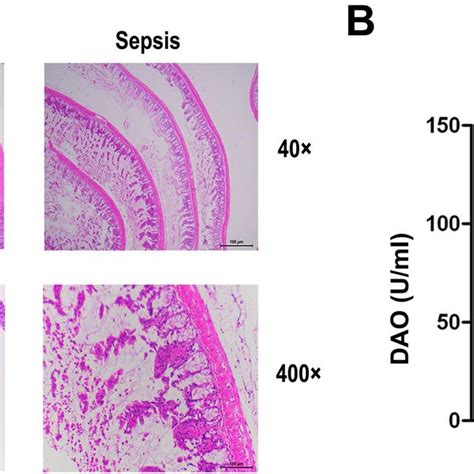 Sepsis Suppresses Intestinal Epithelial Cell Proliferation And Induces Download Scientific