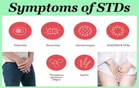 Best Doctors For Candidiasis Treatment In Delhi Best Sti Doctor And