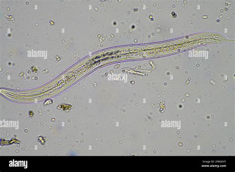 Soil Microbes In A Compost On A Farm In India Stock Photo Alamy