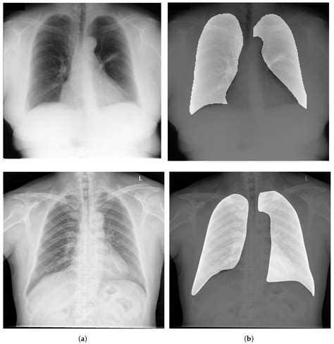 diagnostics free full text a review of recent advances in deep