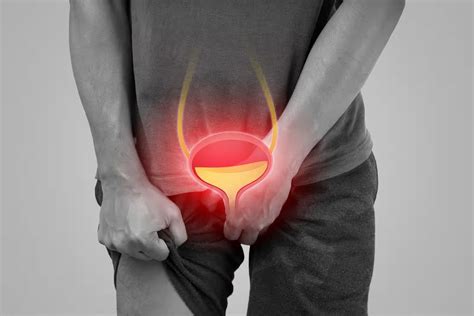 40 Facts About Urinary Retention