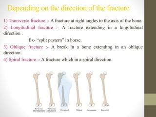 Vsr610 Ppt Fracture Pptx Classification Of Fractures Pptx