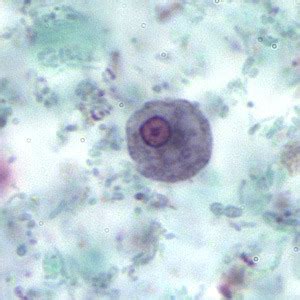 Parasitology Practical Pictures Flashcards Quizlet