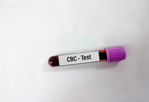 Albumin Test Chimera Medical