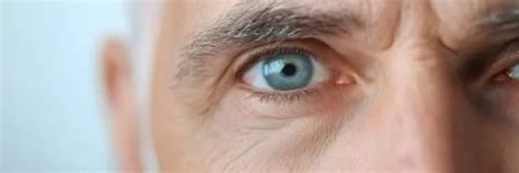 Learn How To Report Eyelid Retraction Correctly Optometry Ophthalmology Coding