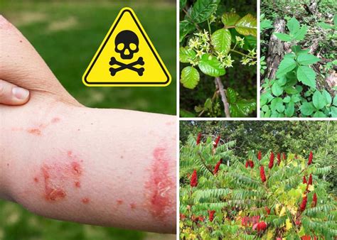 Beware Of Poison Sumac Poison Oak And Poison Ivy They Can Wreak