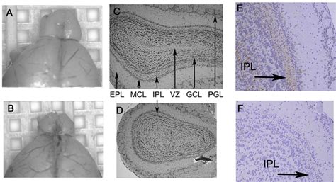 Id2 − − Mice Have A Diminished Olfactory Bulb A B Micrographs Of Download Scientific Diagram
