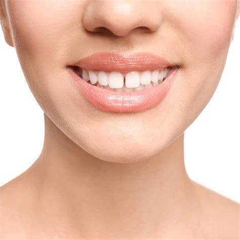 How To Fill Gaps Between Teeth Your Guide To Diastema