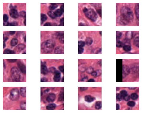 Patch Extraction From Histology Images Tia Toolbox 160 Documentation