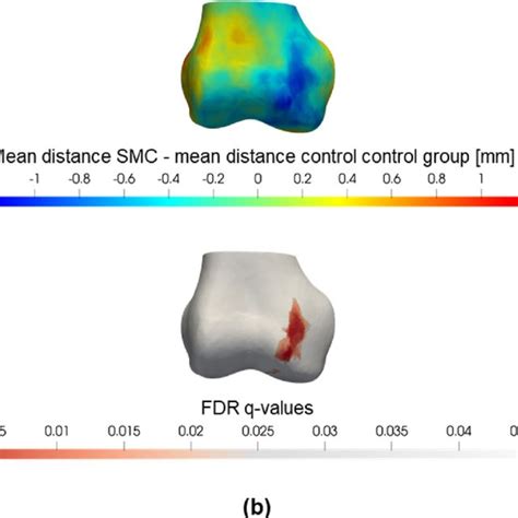 Upper Part Colour Map Of The Mean Femoral Shape Differences Between Download Scientific