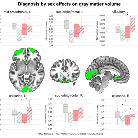 Diagnosis By Sex Effects On Brain Morphology The Brain Clusters Download Scientific Diagram
