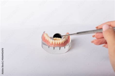 Render Of Mandibular Prosthesis All On 4 System Supported By Implants Over White Background