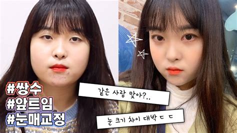 팡펭펭 Vlog 쌍수 Make Over🧡눈성형 하면 무조건 성공할 눈이란 이런것 무쌍에서 절개 눈매교정 앞트임 하고 나니 완전 딴사람 ㄷㄷ 안검하수 너무 편해졌어요