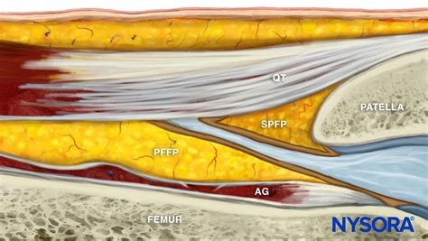 Tips For Scanning The Quadriceps Tendon In A Longitudinal Orientation
