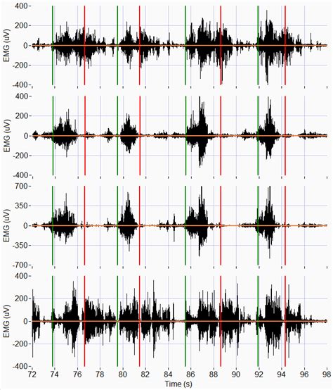 Surface Emg Signals Acquired Simultaneously From Four Muscles From Top