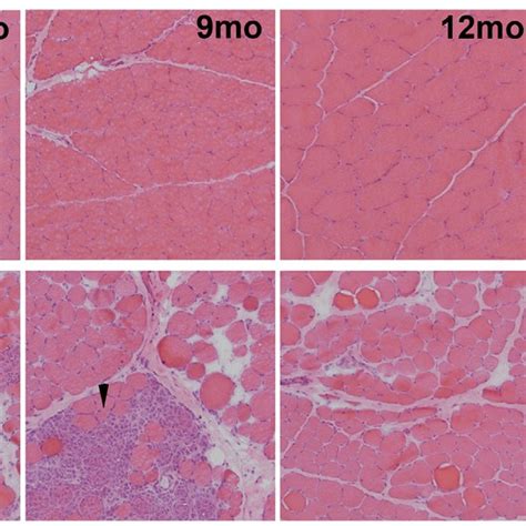 Haematoxylin And Eosin Staining Reveals Dystrophic Pathology