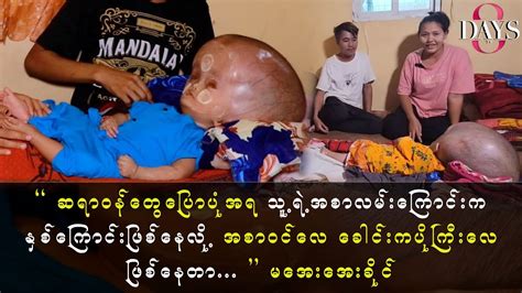 ဆရာဝန်တွေပြောပုံအရ သူ့ရဲ့အစာလမ်းကြောင်းက နှစ်ကြောင်းဖြစ်နေလို့ အစာဝင်လေ