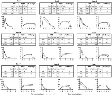 Nine Different Spirograms Used In Physician Interpretation Download