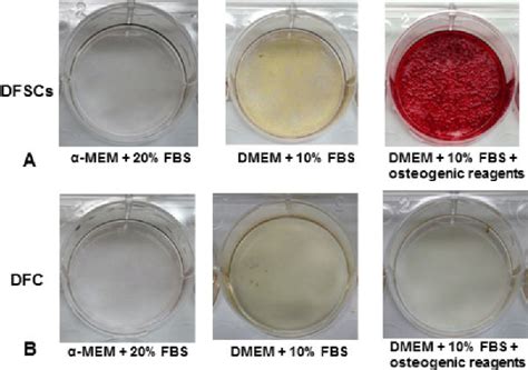 Figure 2 From The Role Of Dentin Matrix Protein 1 Dmp1 In Regulation Of Osteogenic