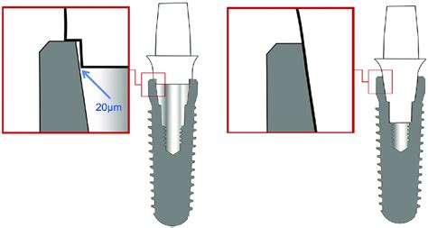 Schematic Drawing Of Different Abutment Configurations Download Scientific Diagram