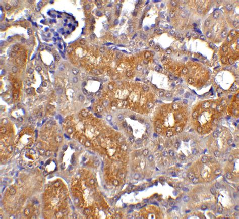 Dff40cad Antibody Bsa Free Nbp1 77009 By Novus Part Of Bio Techne