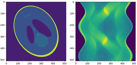 Sinogram Analysis Using Attention U Net A Methodological Approach To
