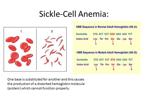 Sickle Cell Anemia Worksheet Get The Answer Key For Comprehensive