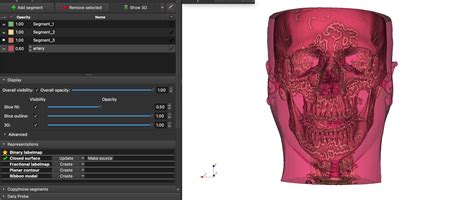 Shadow Rendering Issue With Transparency Support 3d Slicer Community