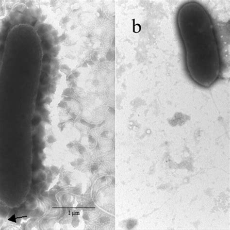 Fluoroscopic Electron Microscope Av Alginolyticus Hd 1 Bv Download Scientific Diagram