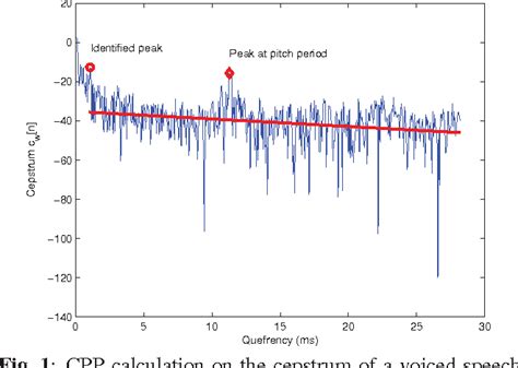 Figure 1 From Voice Source Features For Cognitive Load Classification