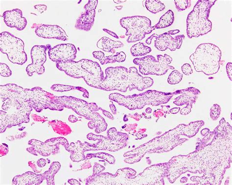 Chorionic Villi Histology Implantation And Placenta Basicmedical Key