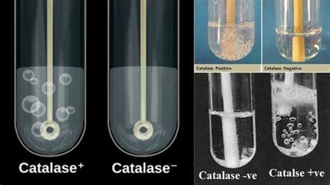 Catalase Test Principle Procedure Result And Application Biology Notes Online