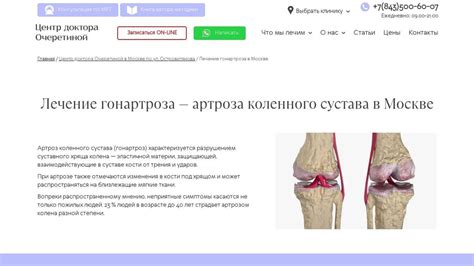 Лечение гонартроза — артроза коленного сустава в Москве