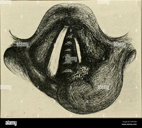 Transactions Of The Sixth International Congress On Tuberculosis Washington September 28 To