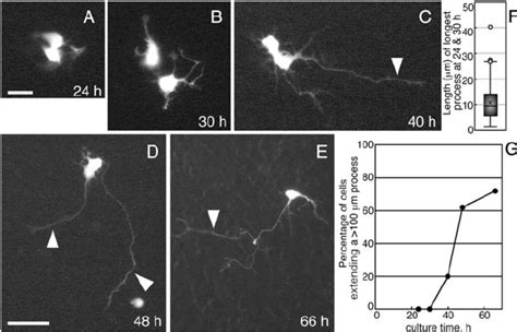 Time Course Of Appearance Of Excitatory Cortical Neurons With A Long