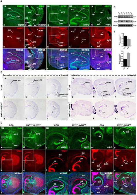 The Differentiation And Integration Of The Hippocampal Dorsoventral