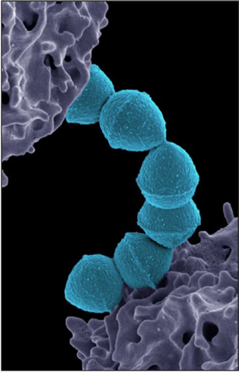 Streptococcus