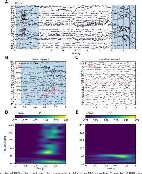 Figure 1 From Improved Manual Annotation Of Eeg Signals Through Convolutional Neural Network