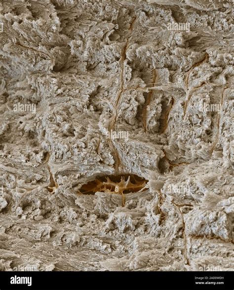 Osteocyte Bone Cell Coloured Scanning Electron Micrograph Sem Of An