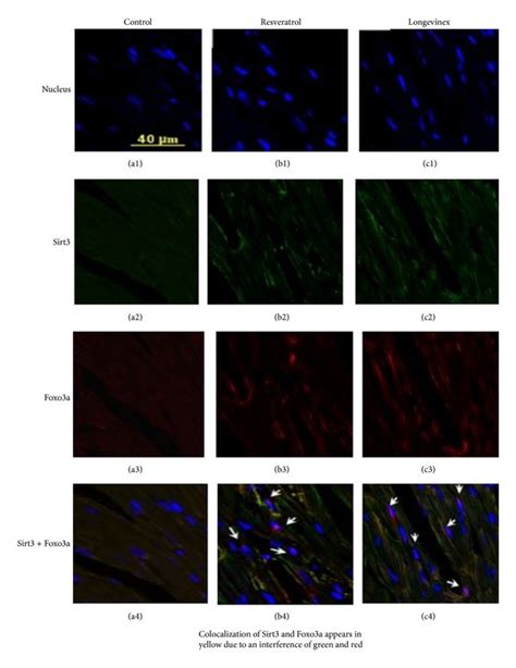 Immunofluorescence Multichromatic Projections Of Mitochondrial Sirt3 Download Scientific