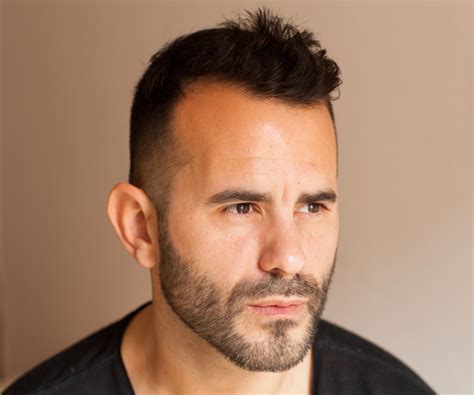 Prp Injections New York Vampire Facial