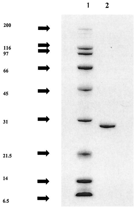 Alignment Used To Generate The Homology Model Of Spm 1 Asterisks
