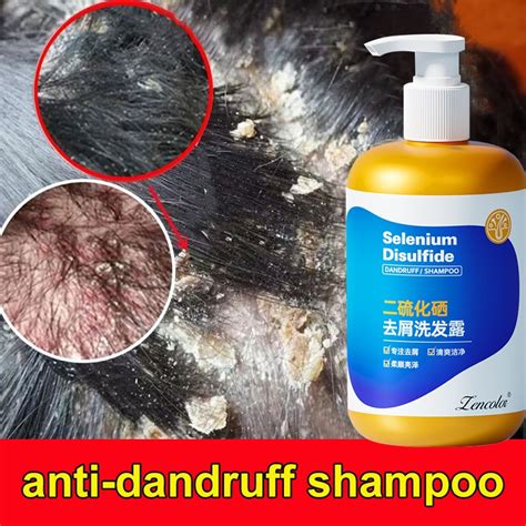 Shampoo Kelemumur Dandruff Shampoo Selenium Disulfide Anti Dandruff Shampoo 300ml Effectively