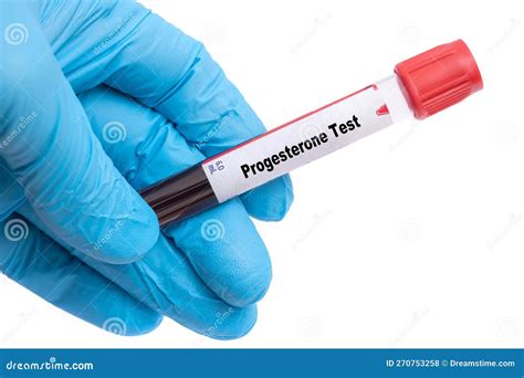Progesterone Test Medical Check Up Test Tube With Biological Sample Stock Photo Image Of