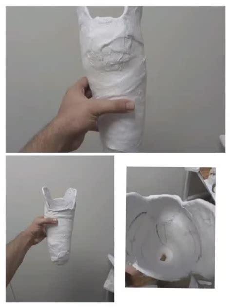 Wisal Shah On Linkedin Transtibial Prosthesis Tsb Socket With