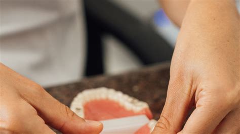 🦷 Interimsprothese Preise Behandlung Und Alternativen