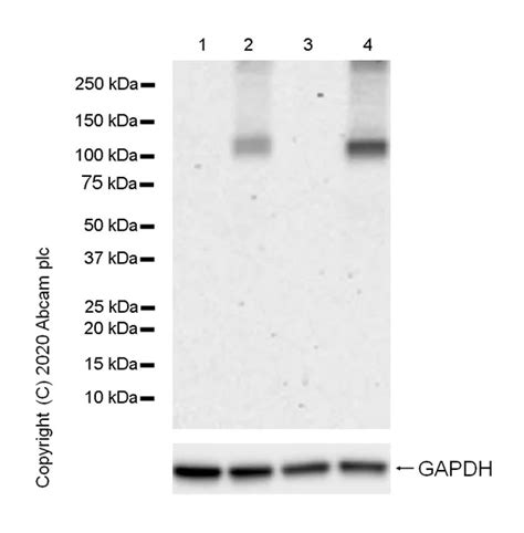 Anti Hif 1 Alpha Antibody 54hif 1a Ab279654 Abcam