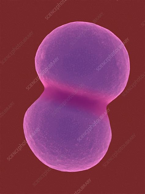 Staphylococcus Aureus SEM Stock Image C Science Photo Library