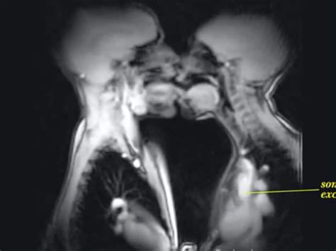 So Sieht Sex Im Mrt Aus Vol At