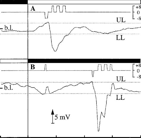 Potential Difference And Local Negative Electrical Feedback Excitation Download Scientific